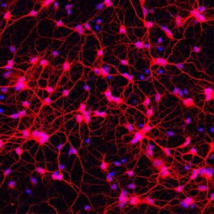 Direct reprogramming: another way of making human neurons | Eurostemcell