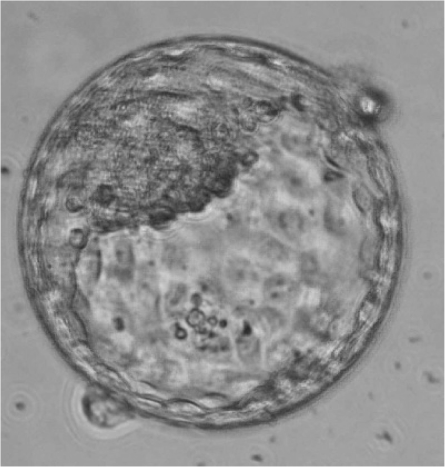 Human Blastula