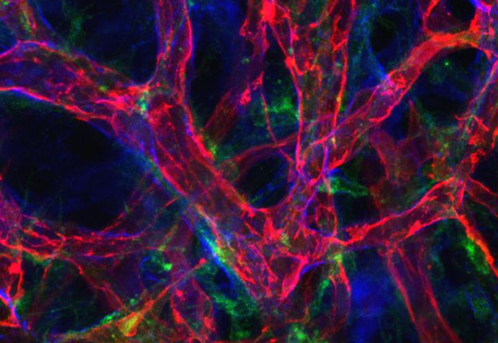 Organoids: what are they and how do they help regenerative medicine ...